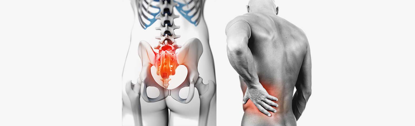 Sacroiliac Joint Pain and Dysfunction - Philip Wood Physiotherapy